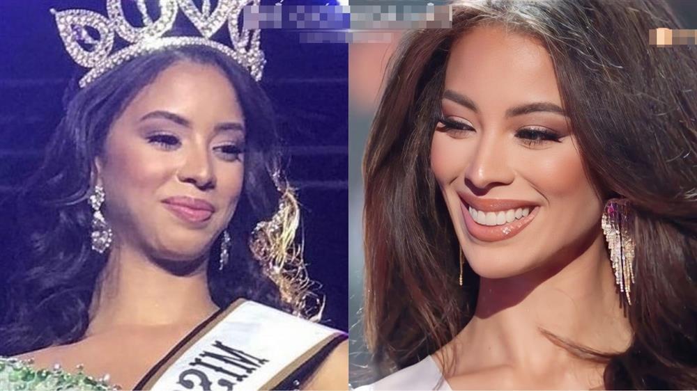 Lộ bằng chứng Á hậu 2 Miss Universe 2022 từng can thiệp thẩm mỹ?